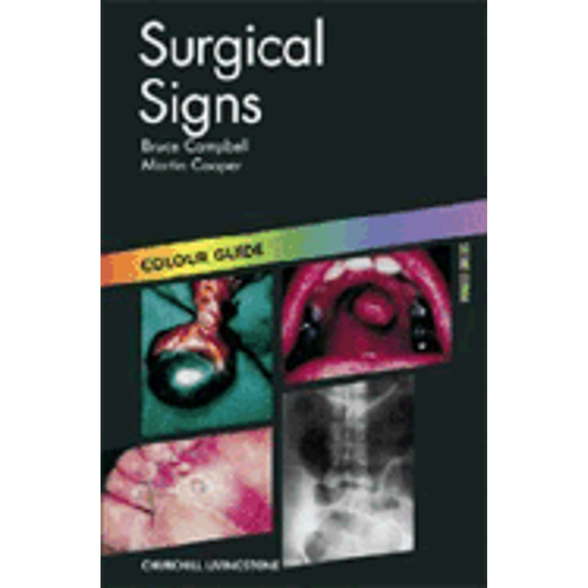 Surgical Signs: Colour Guide (Paperback) by Bruce Campbell, Martin ...