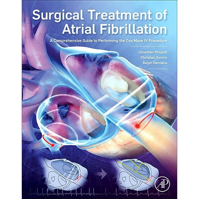 Surgical Treatment of Atrial Fibrillation: A Comprehensive Guide to Performing the Cox Maze IV ...