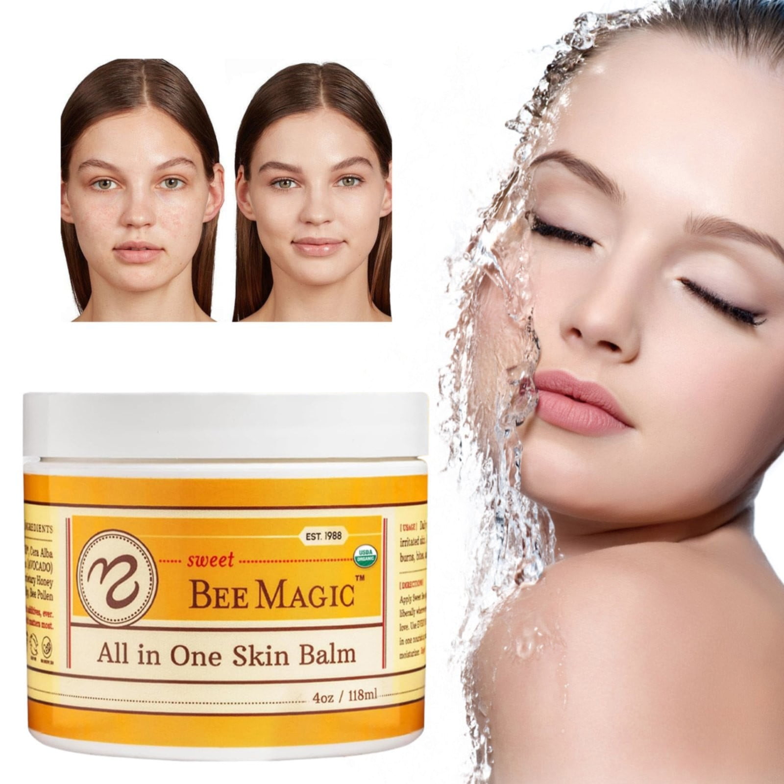 Sweet Bee Naturals Daily Moisturizer, All Natural Skin Balm for Dryness ...