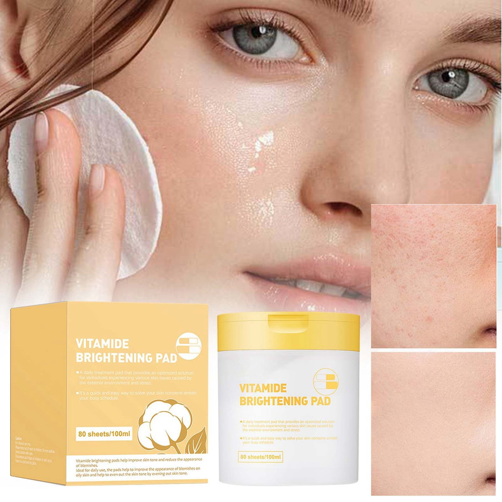 Sweet Chef Skin Care head Remover How to Get Glowing Skin Your Good ...