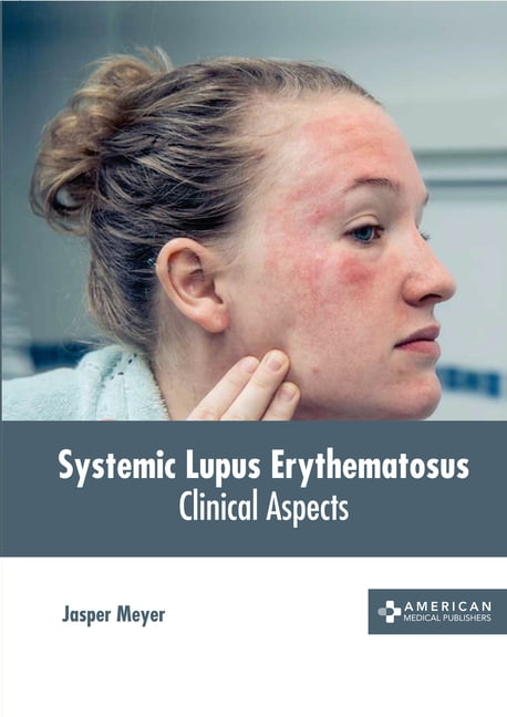 Systemic Lupus Erythematosus: Clinical Aspects, (Hardcover) - Walmart.com