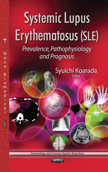 Systemic Lupus Erythematosus, Sle : Prevalence, Pathophysiology and ...