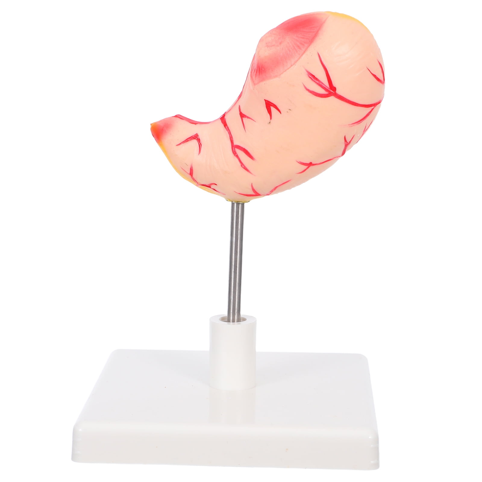 TEHAUX Stomach Dissection Model: Stomach Health Model for Medical ...