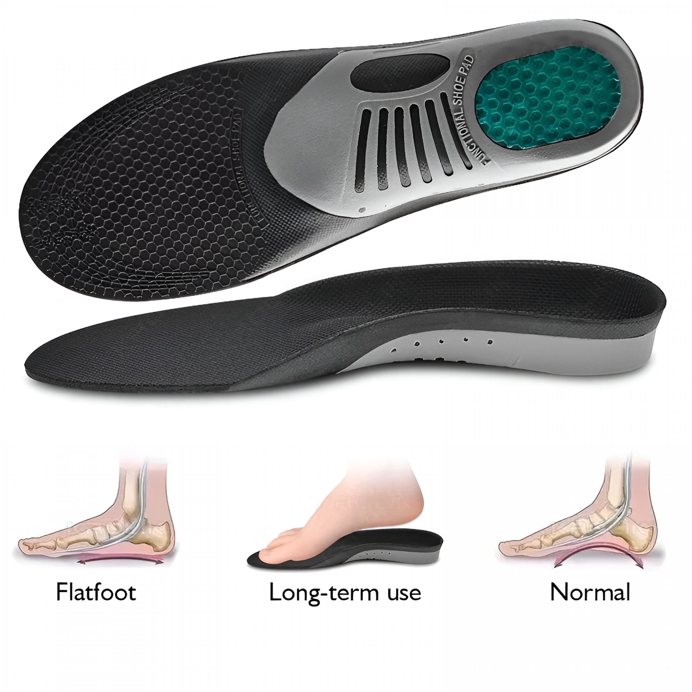 TELOLY Flat Feet Template Arch Support Orthopedic Insoles,Plantar ...
