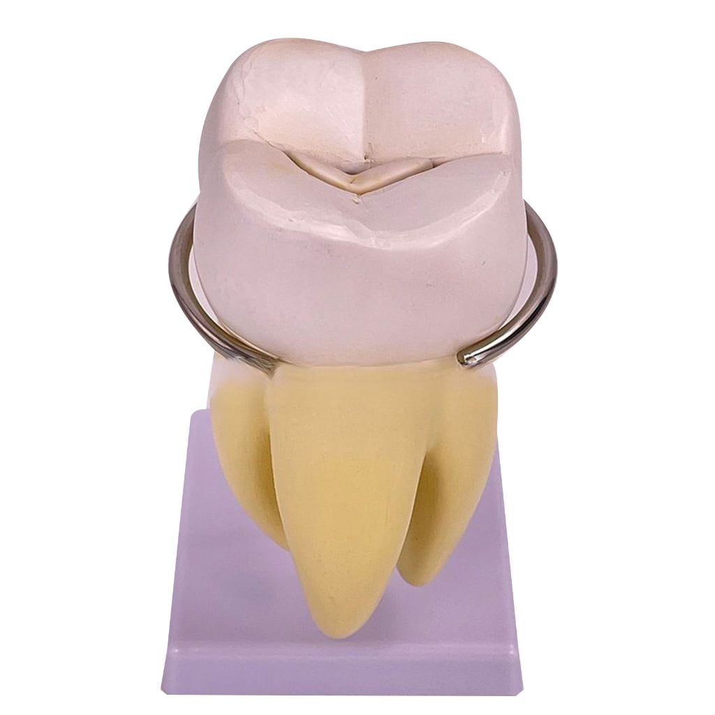 TIERPOP Molar Tooth Anatomy Model with Detachable Parts Human Tooth ...