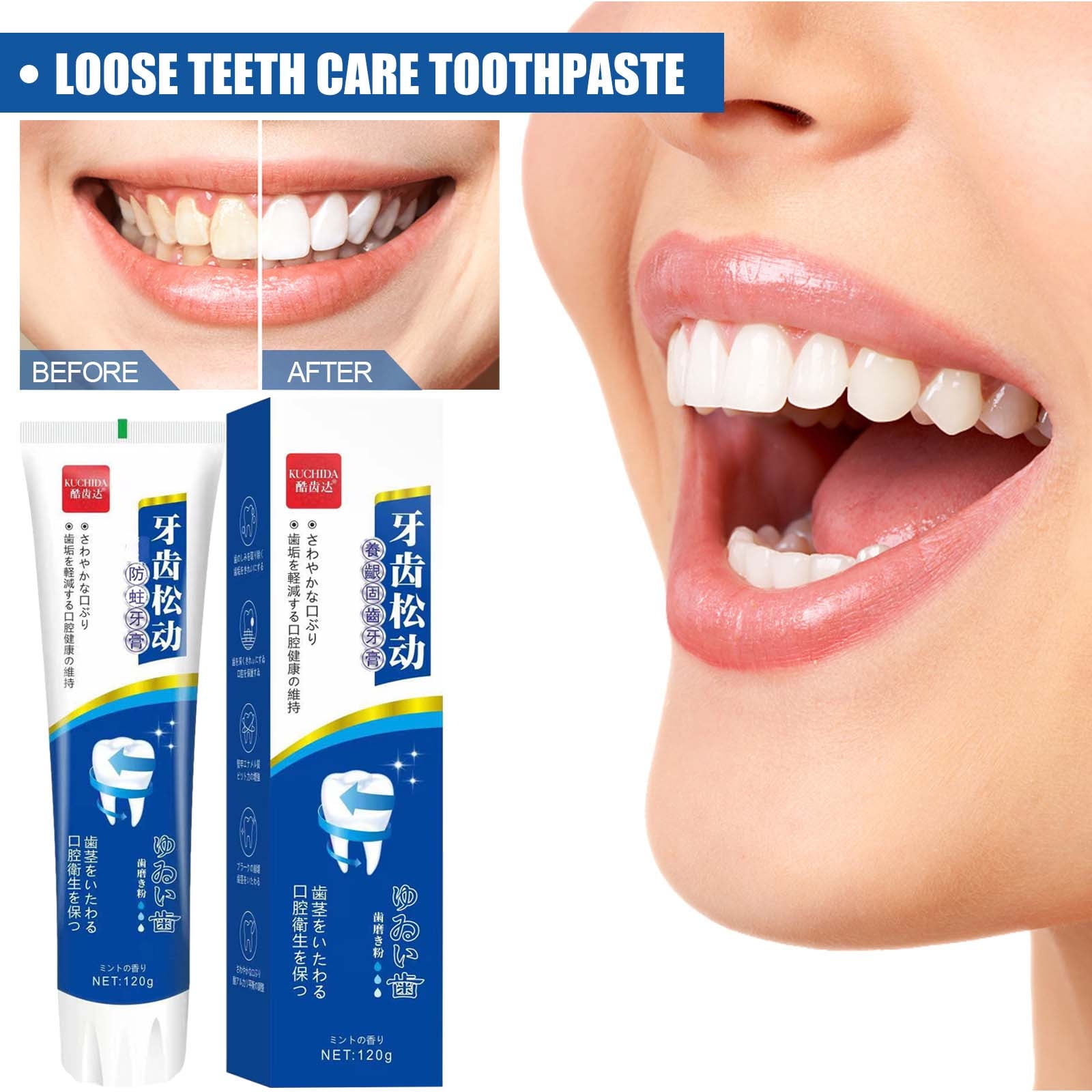 TOOPTY Tooth Looseness And Teeth Toothpaste Whitening Teeth, Refreshing ...