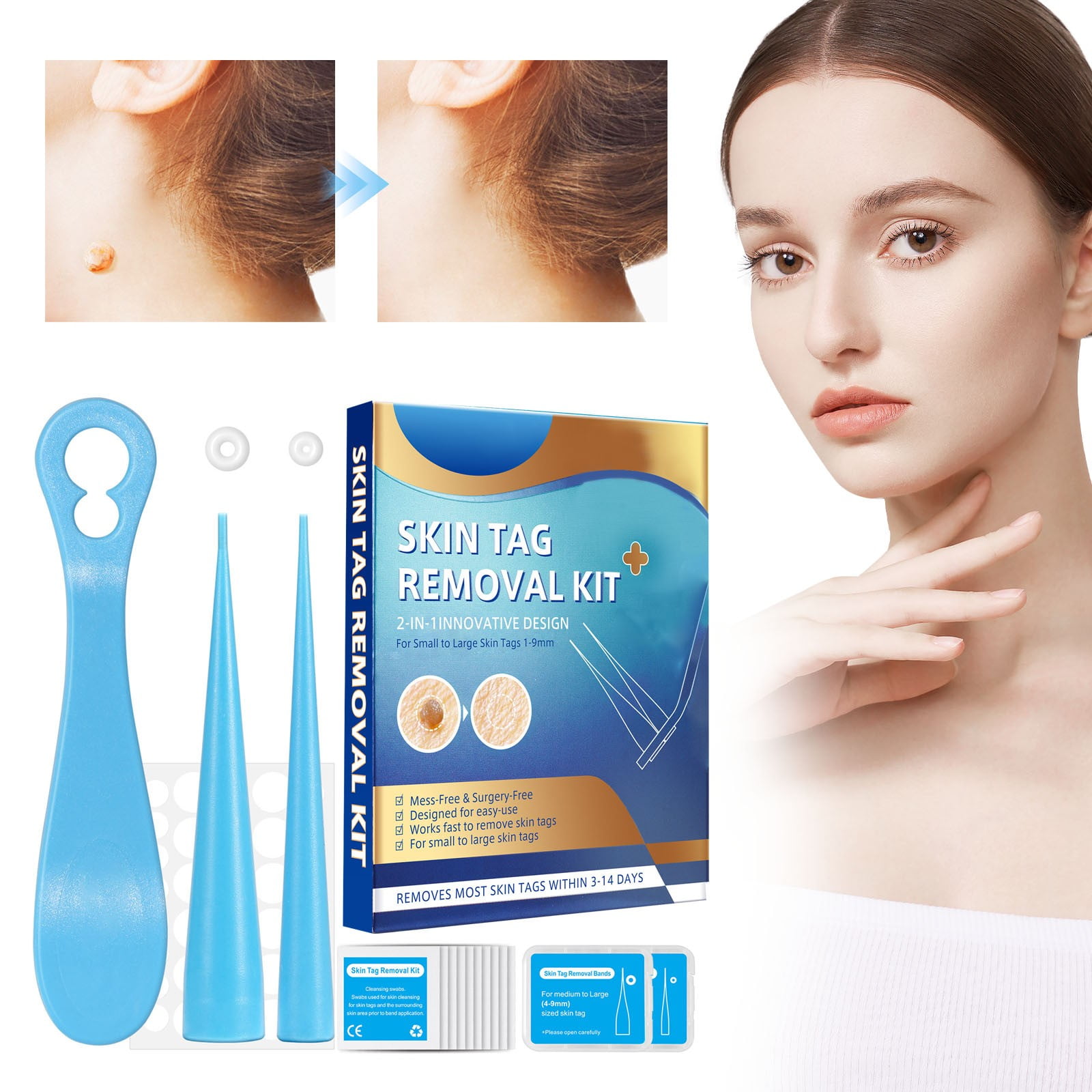 TROLL Skin Tag Pimple Removal Kit Best Pimple Remover For Men And Women ...