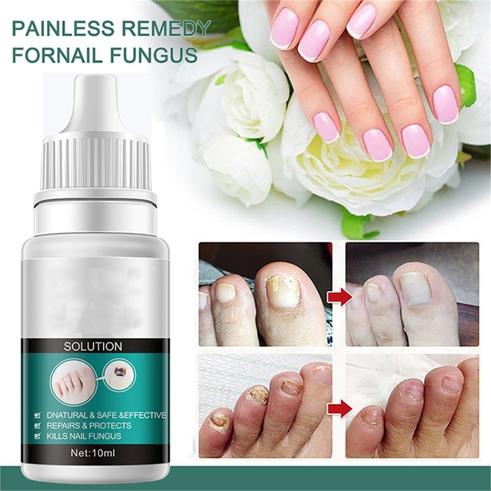 TYTSPEASY Nail Care Solution For Nail Hand Trainer Pedicure Foot File ...