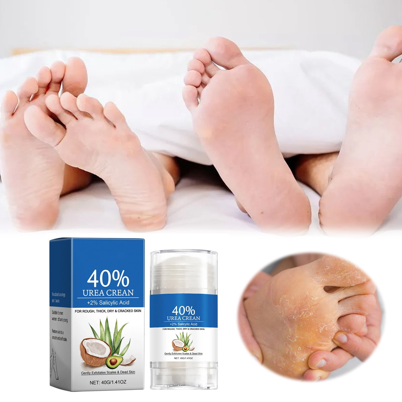 TYTSPEASY Nourishing Foot Exfoliating Deep Moisturizing Care Skin Care ...
