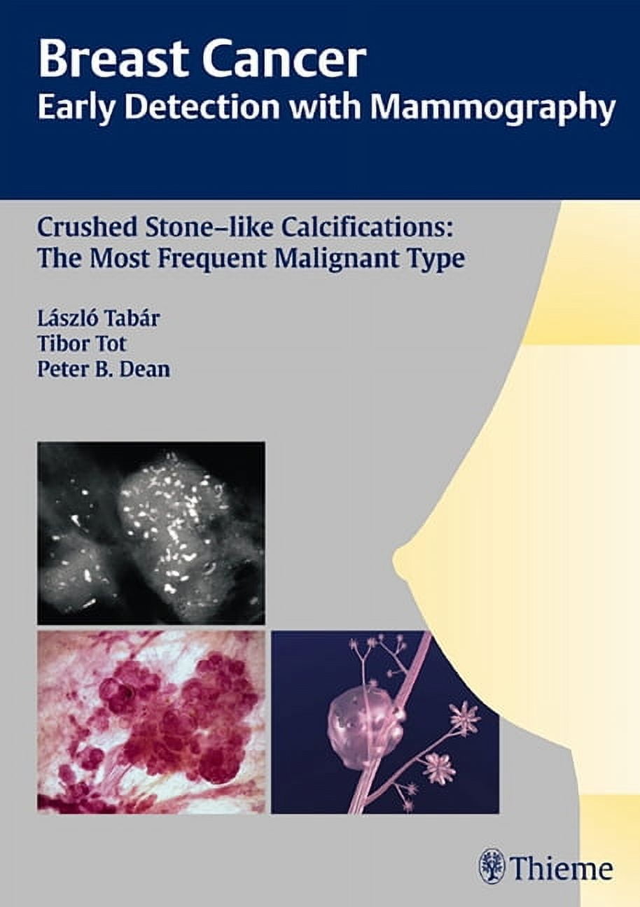 Tabar Mammo Breast Cancer: Early Detection with Mammography: Crushed ...