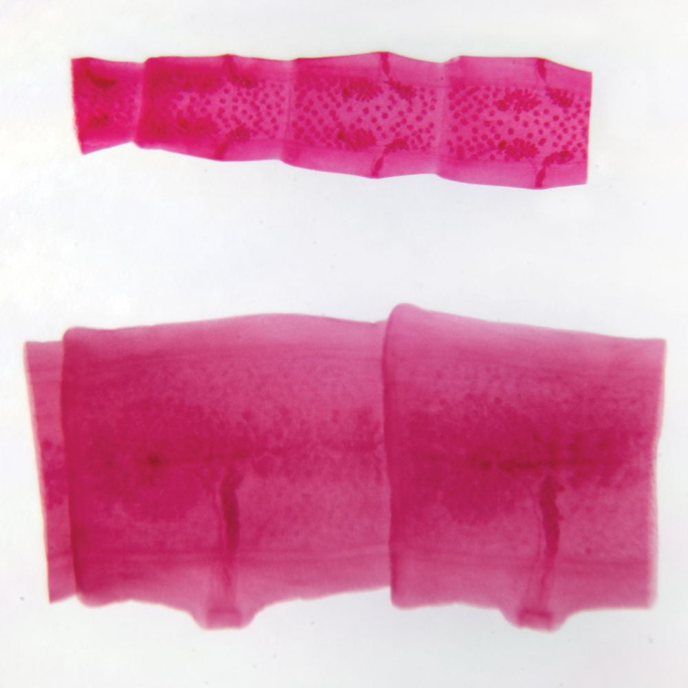 Tapeworm Proglottids Comparison, W.M. Microscope Slide - Walmart.com