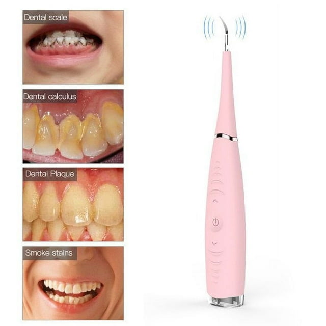Tartar Remover, USB Rechargeable Sonic Tooth Stain Eraser Tartar ...