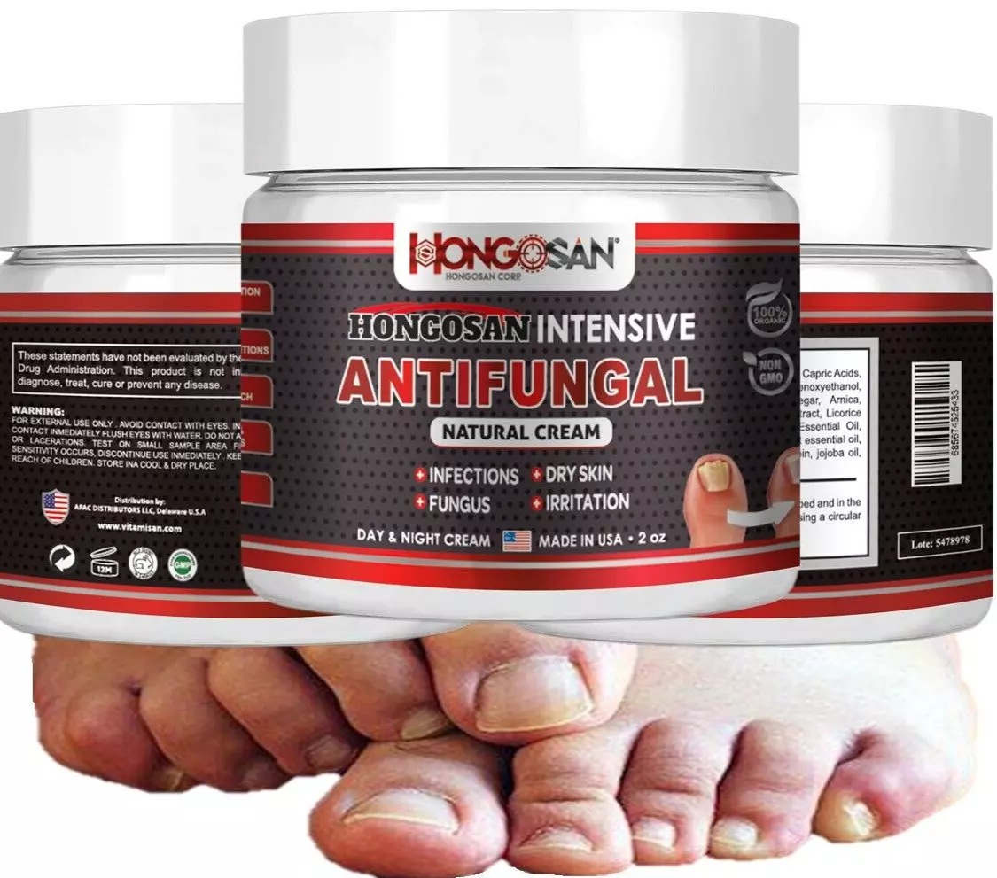 Tea Tree Oil Antifungal Cream Super Balm Athletes Foot,Eczema,Jock Itch ...