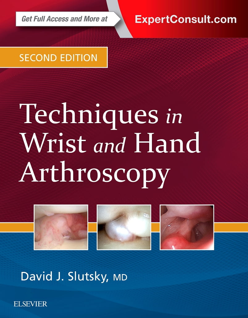 Techniques in Wrist and Hand Arthroscopy - Walmart.com