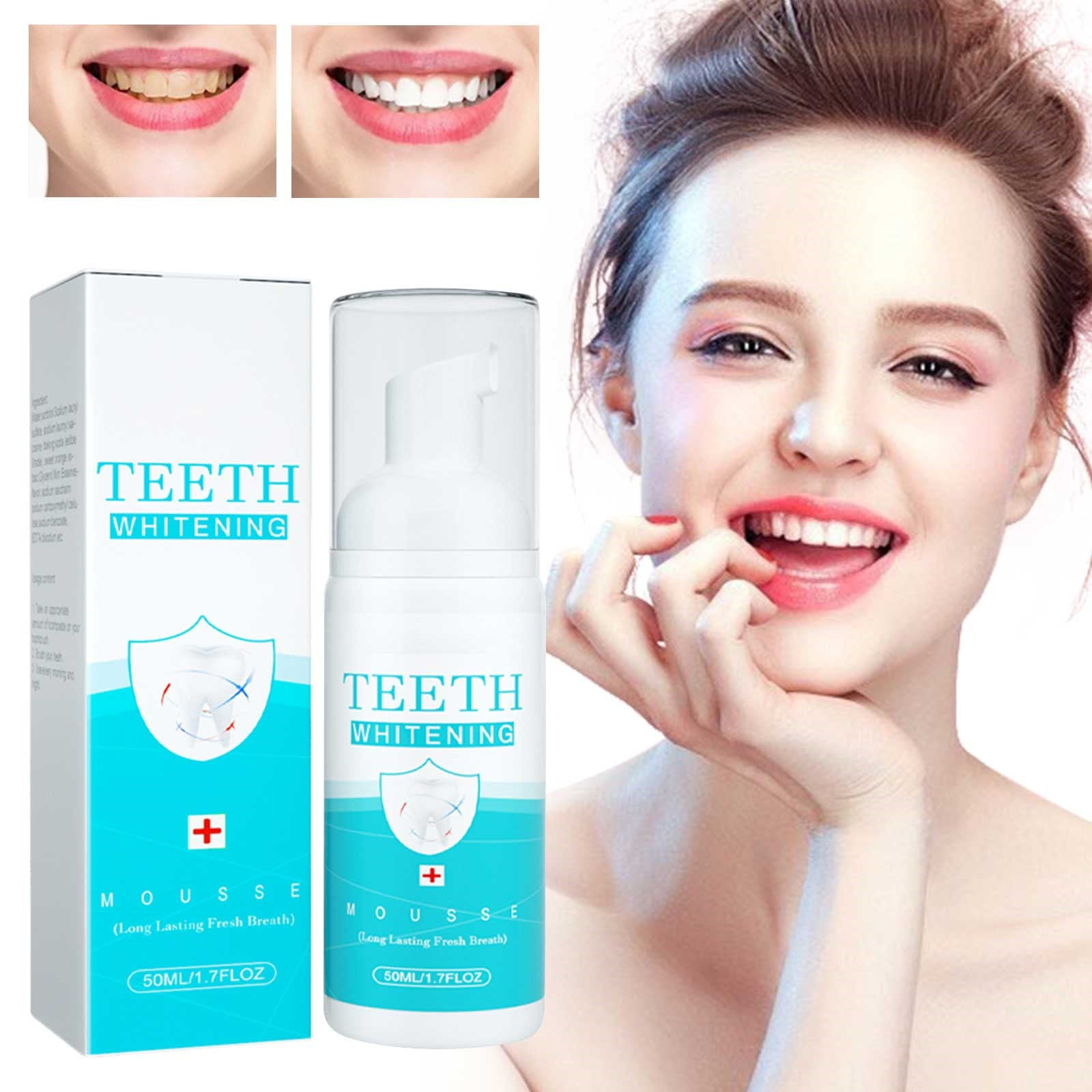 Teeth Cleaning Foam Mousse Toothpaste Tooth Cleaning Foam Mousses Fresh ...