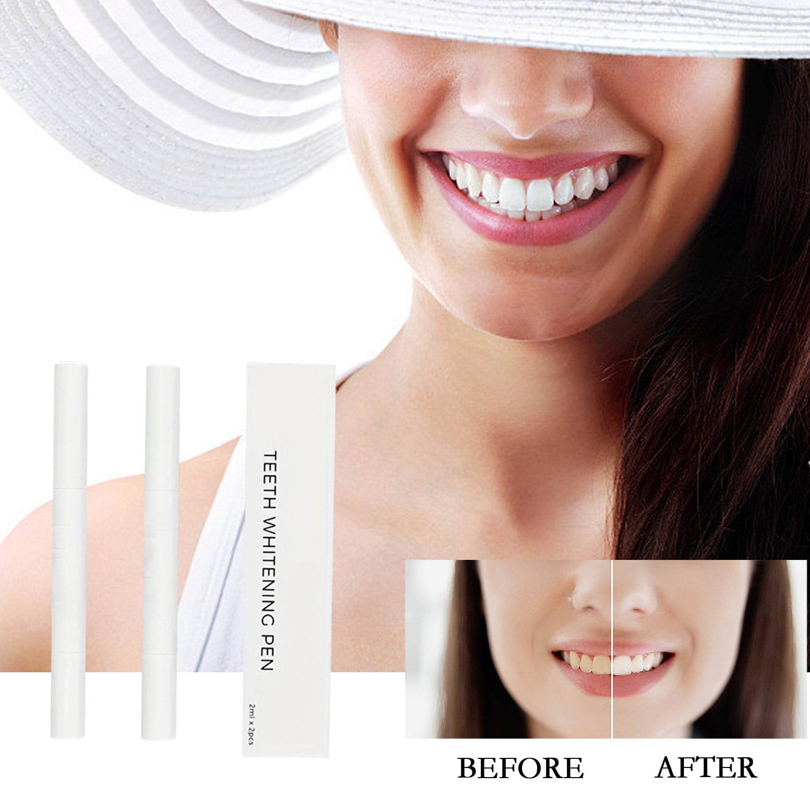Teeth Pen 2 Pack For Instant Overnight Pen Teeth Kit Pens For Teeth ...
