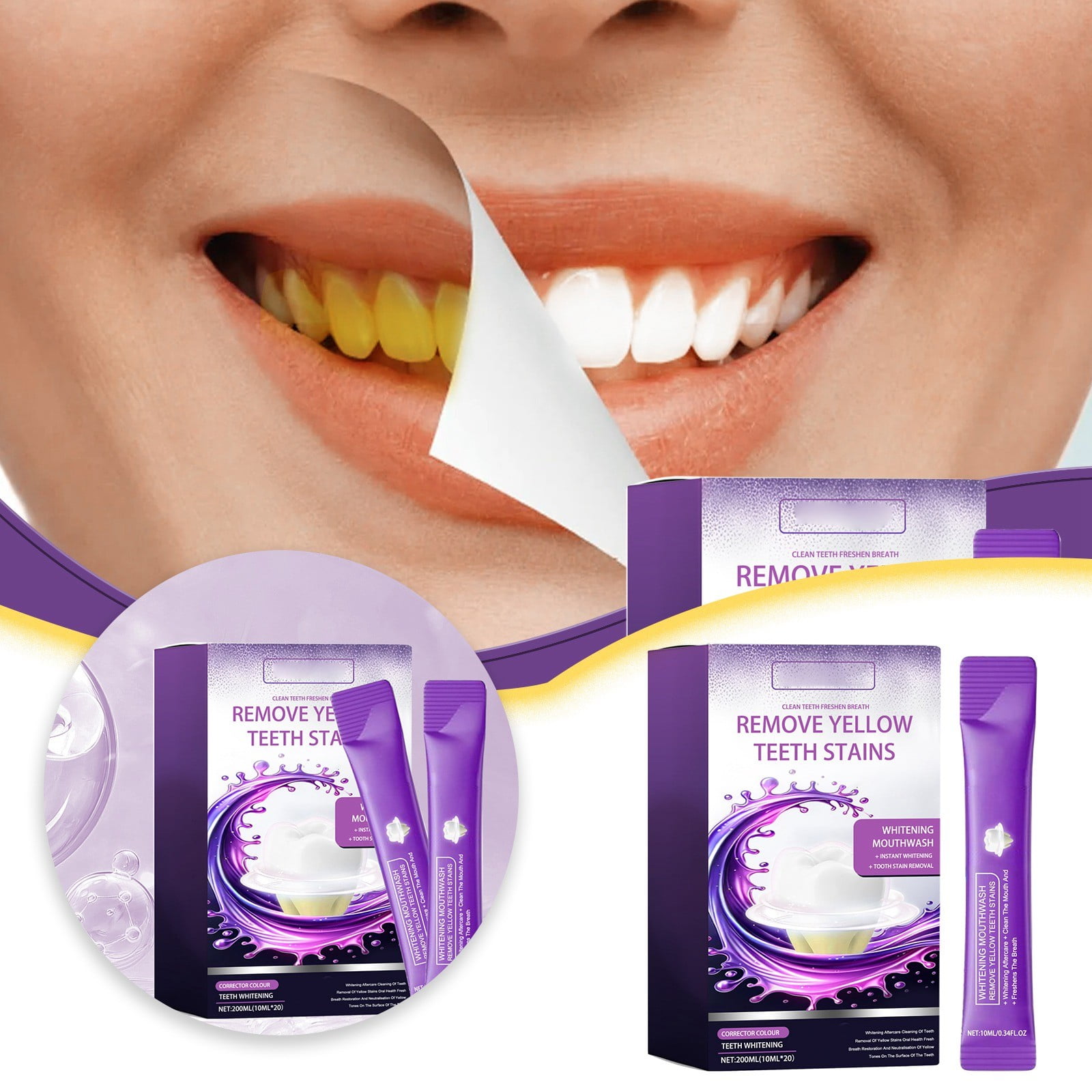 Teeth Retainers to Straighten Teeth Expensive Toothbrush Plaque Removal ...