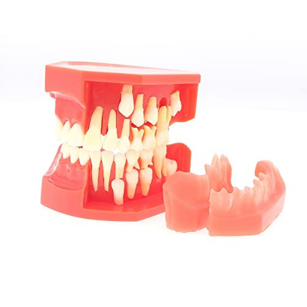 Teeth Typodonts Dental Model #7013 - Teeth Eruption Development Model ...