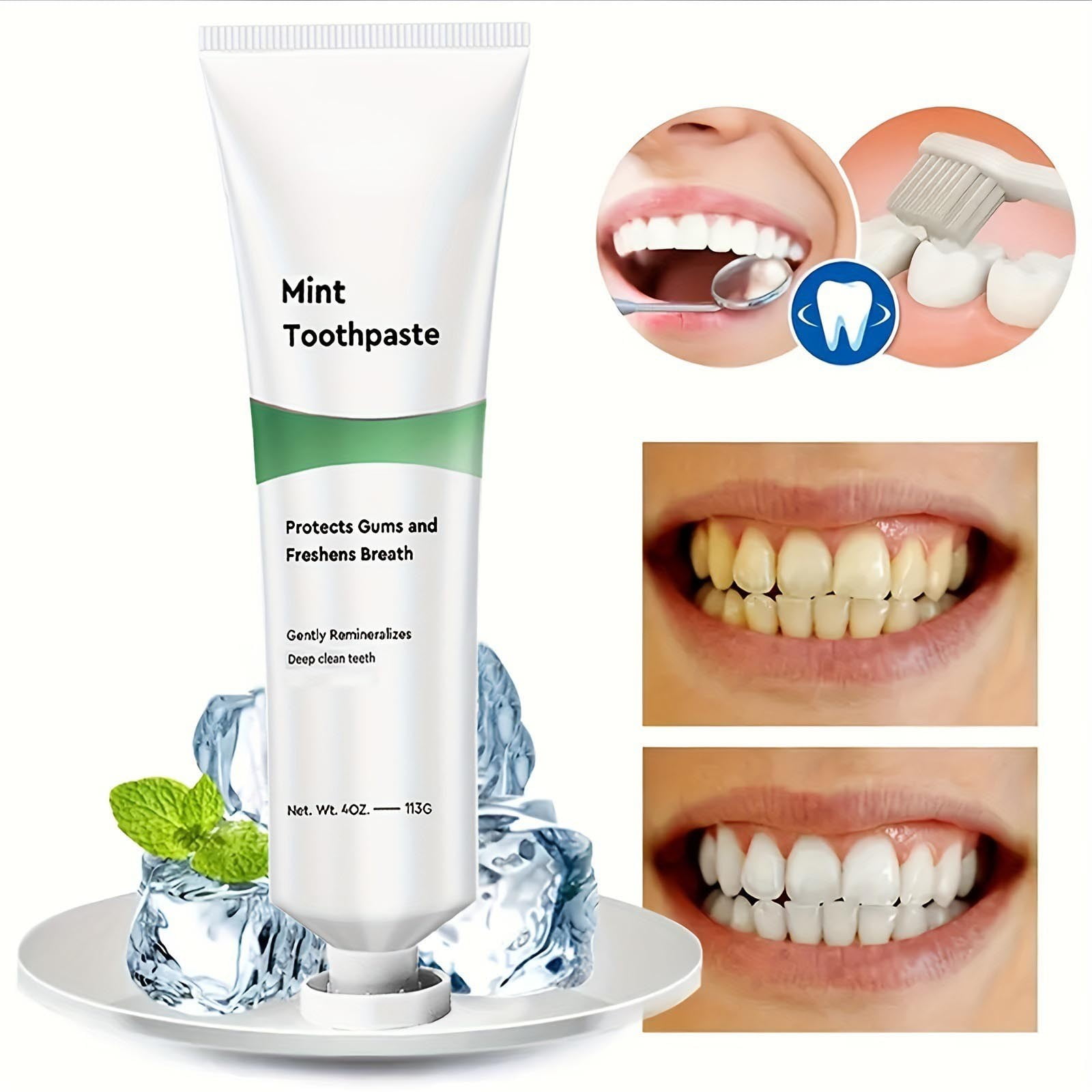 Teeth Whitening Toothpaste | Gingival Cleaning & Enamel Protection ...