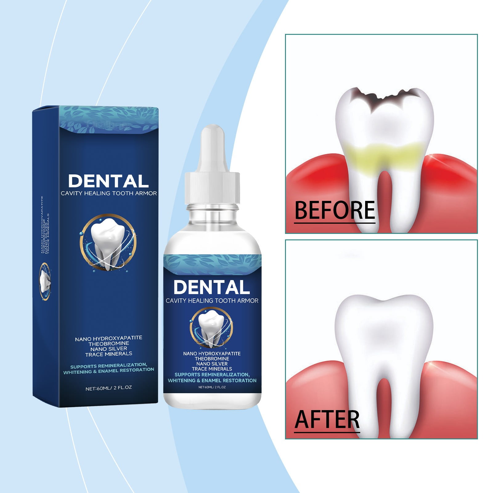 Teeth ning with Light Electric Toothbrush Soft Stuff for Braces ... Teeth ning with Light Electric Toothbrush Soft Stuff for Braces ...