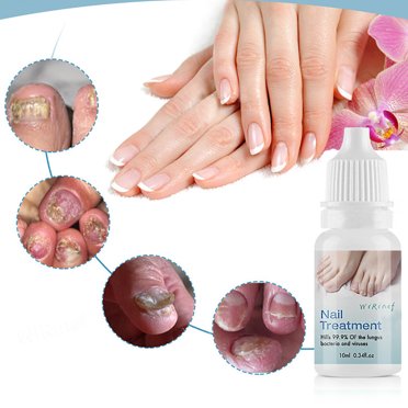 Pkeoh Antibacteria Liquid Of Ash Nail Herbal Ash Nail Care Liquid Ash ...