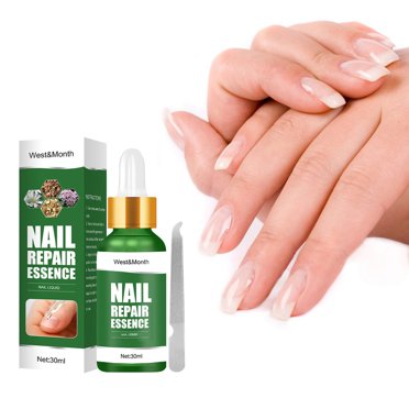 Pkeoh Antibacteria Liquid Of Ash Nail Herbal Ash Nail Care Liquid Ash ...