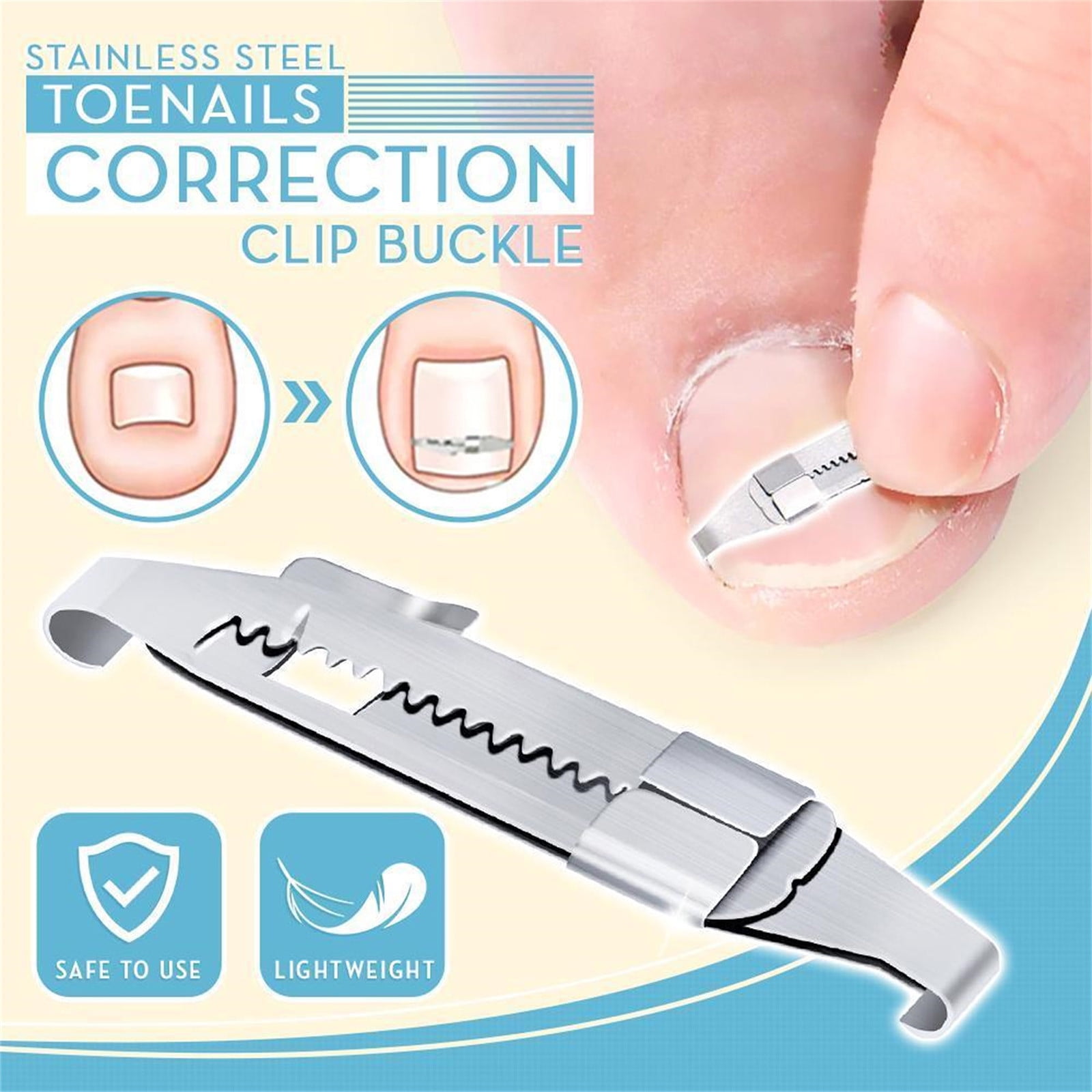 Teissuly Orthopedic Buckle Nail Ingrown Nail Orthosis Toenail Curling ...