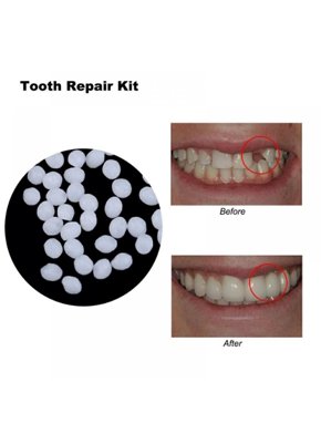 Denture Repair Kit in Denture Care - Walmart.com