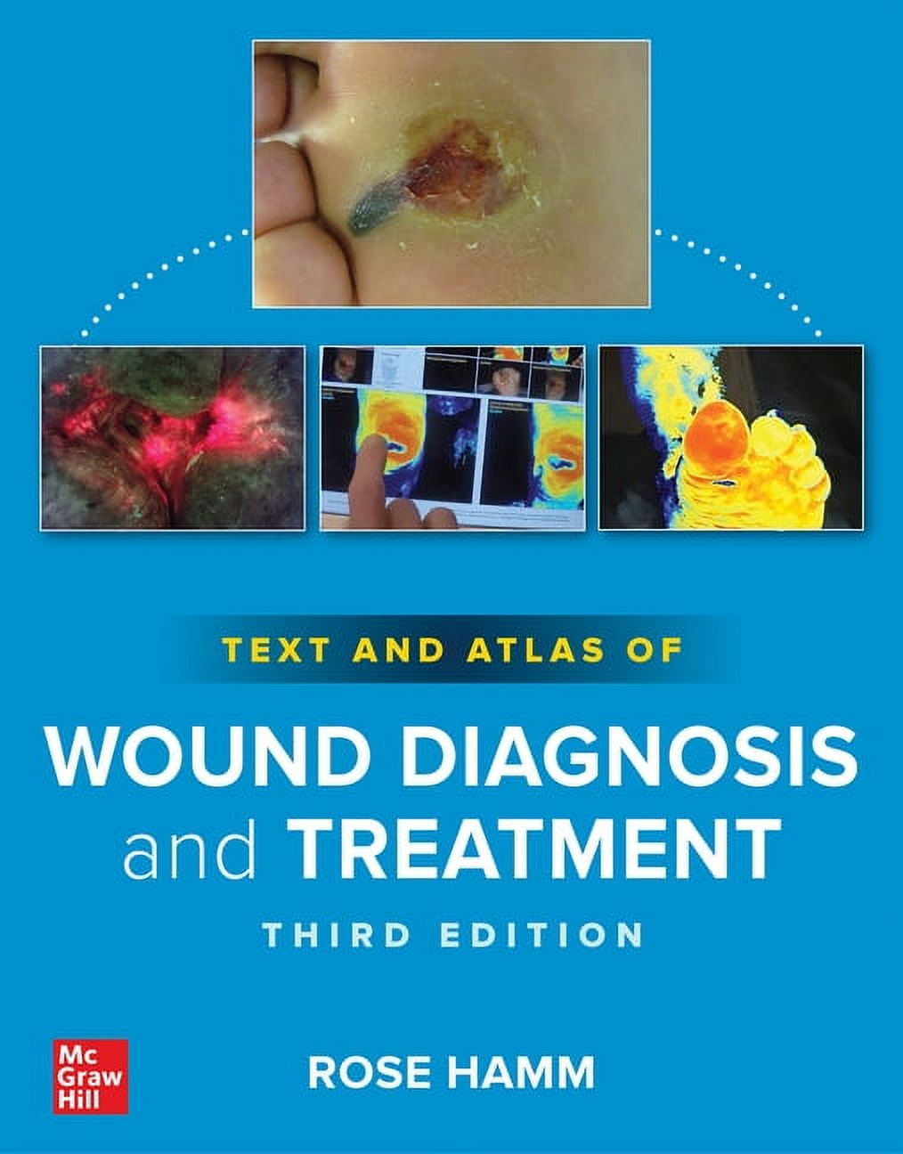 Text and Atlas of Wound Diagnosis and Treatment, Third Edition, (Paperback) - Walmart.com