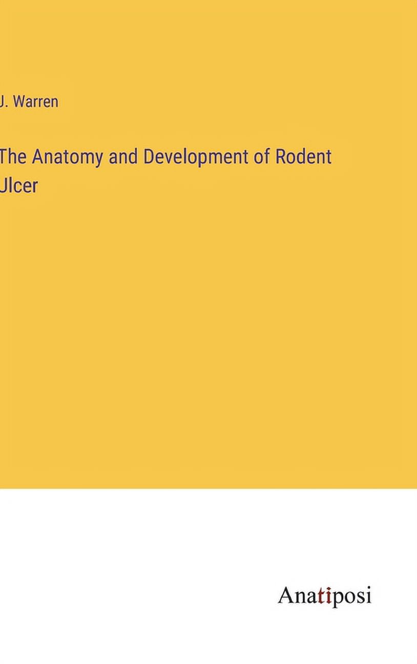 The Anatomy and Development of Rodent Ulcer - Walmart.com