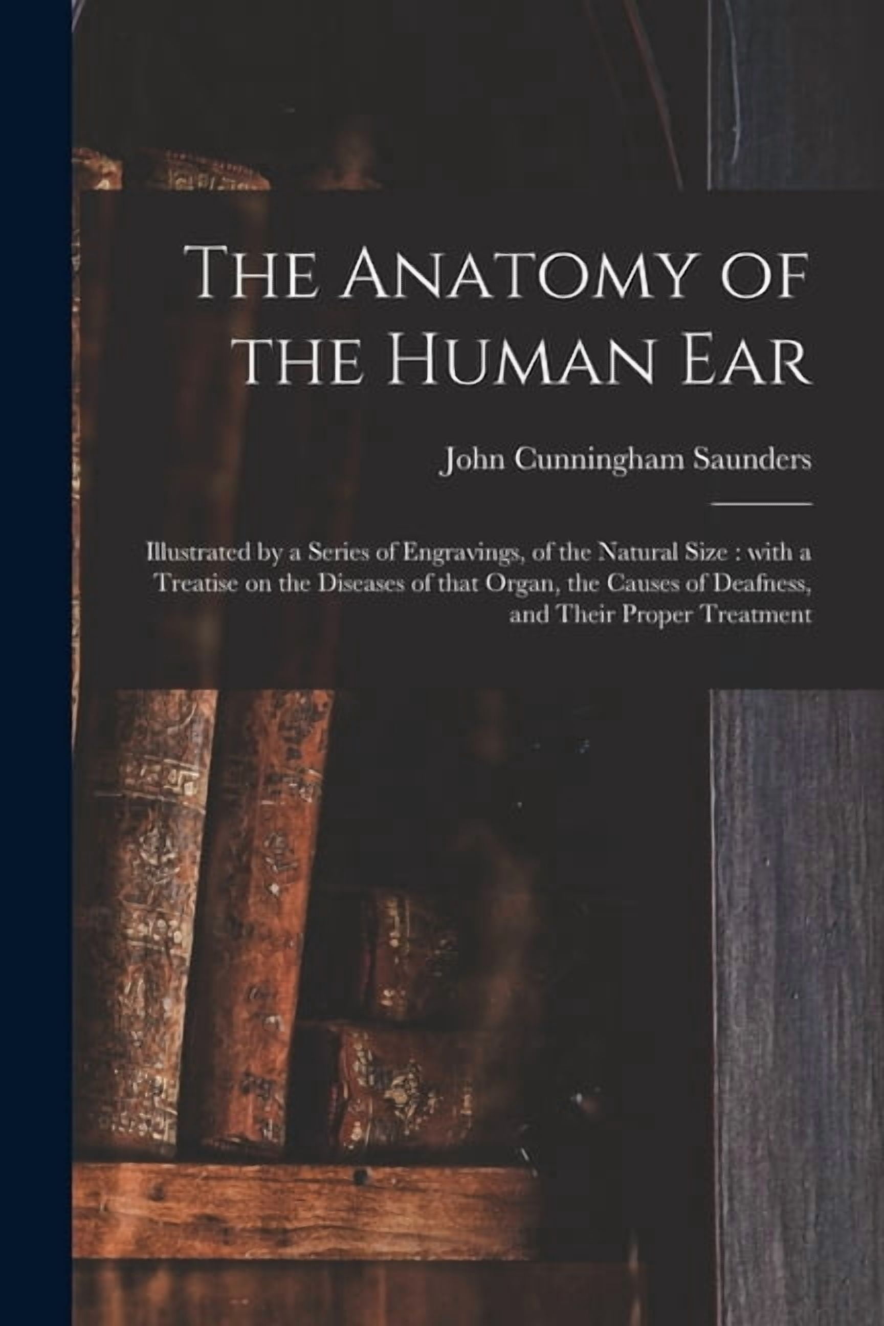 The Anatomy of the Human Ear, (Paperback) - Walmart.com