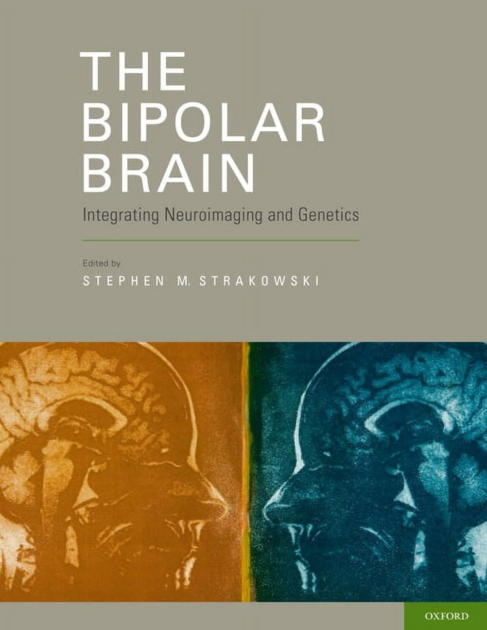 The Bipolar Brain: Integrating Neuroimaging and Genetics, (Hardcover ...