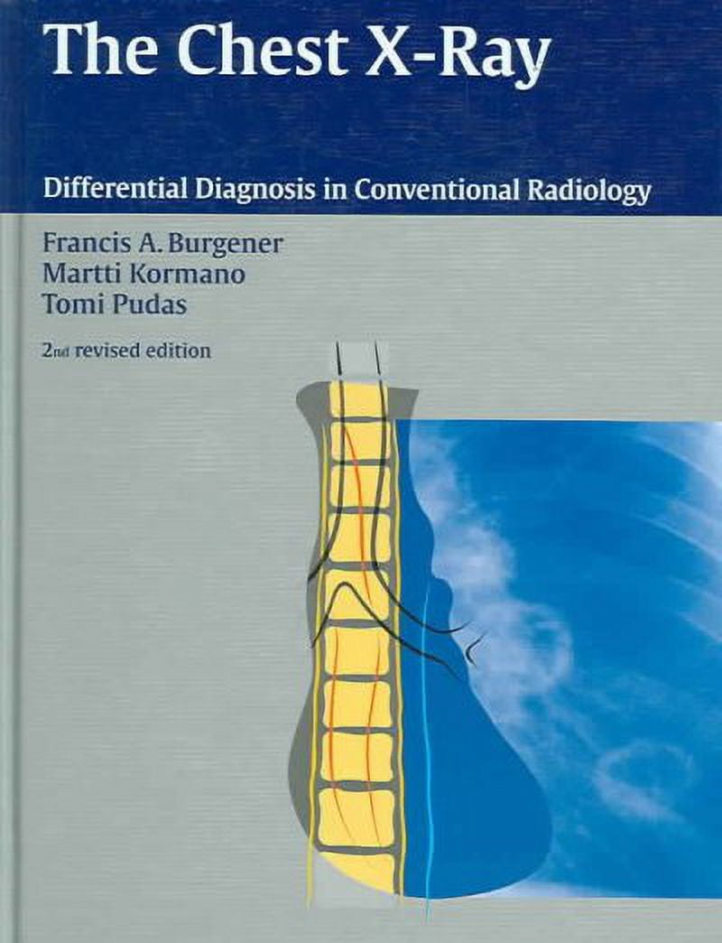 The Chest X-Ray: Differential Diagnosis in Conventional Radiology ...