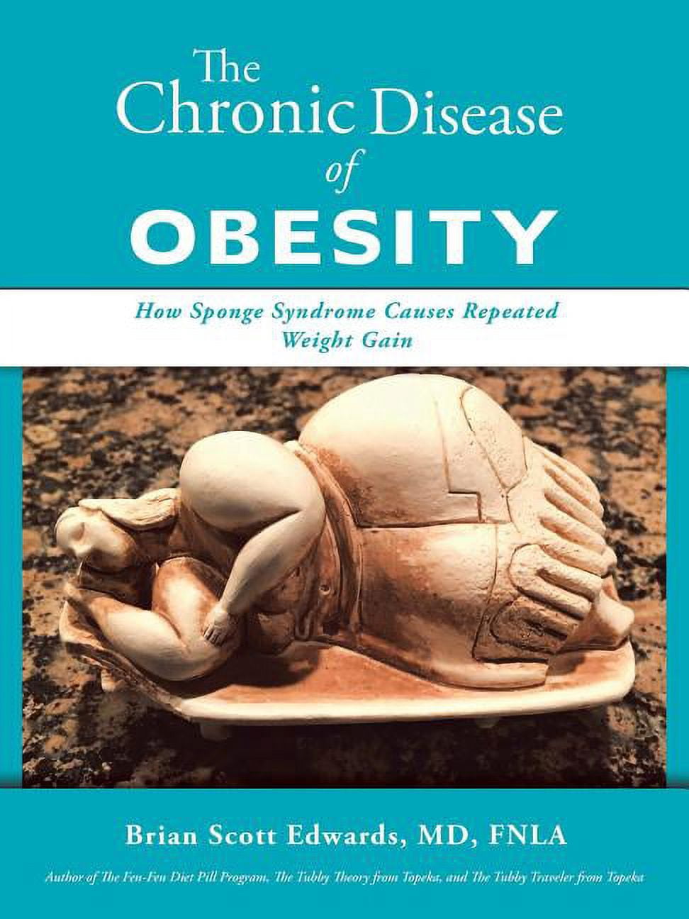 The Chronic Disease of Obesity: How Sponge Syndrome Causes Repeated ...