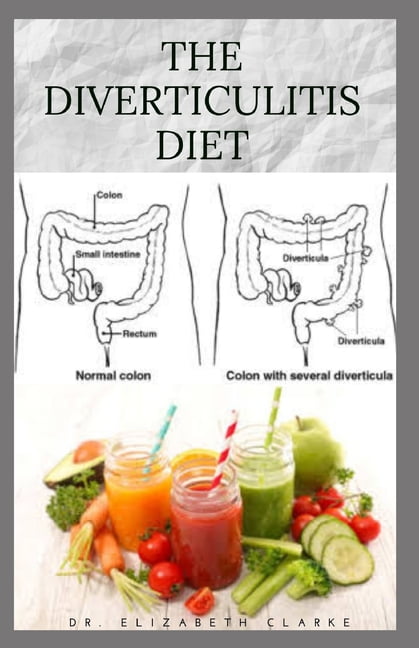 The Diverticulitis Diet (Paperback) - Walmart.com