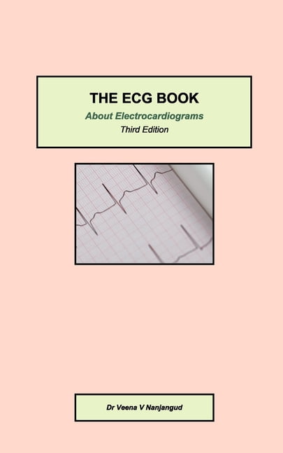 Electrocardiogram Ecg