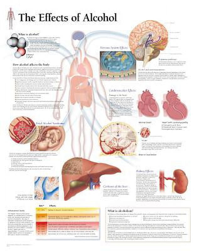The Effects of Alcohol chart : Laminated Wall Chart (Wallchart ...