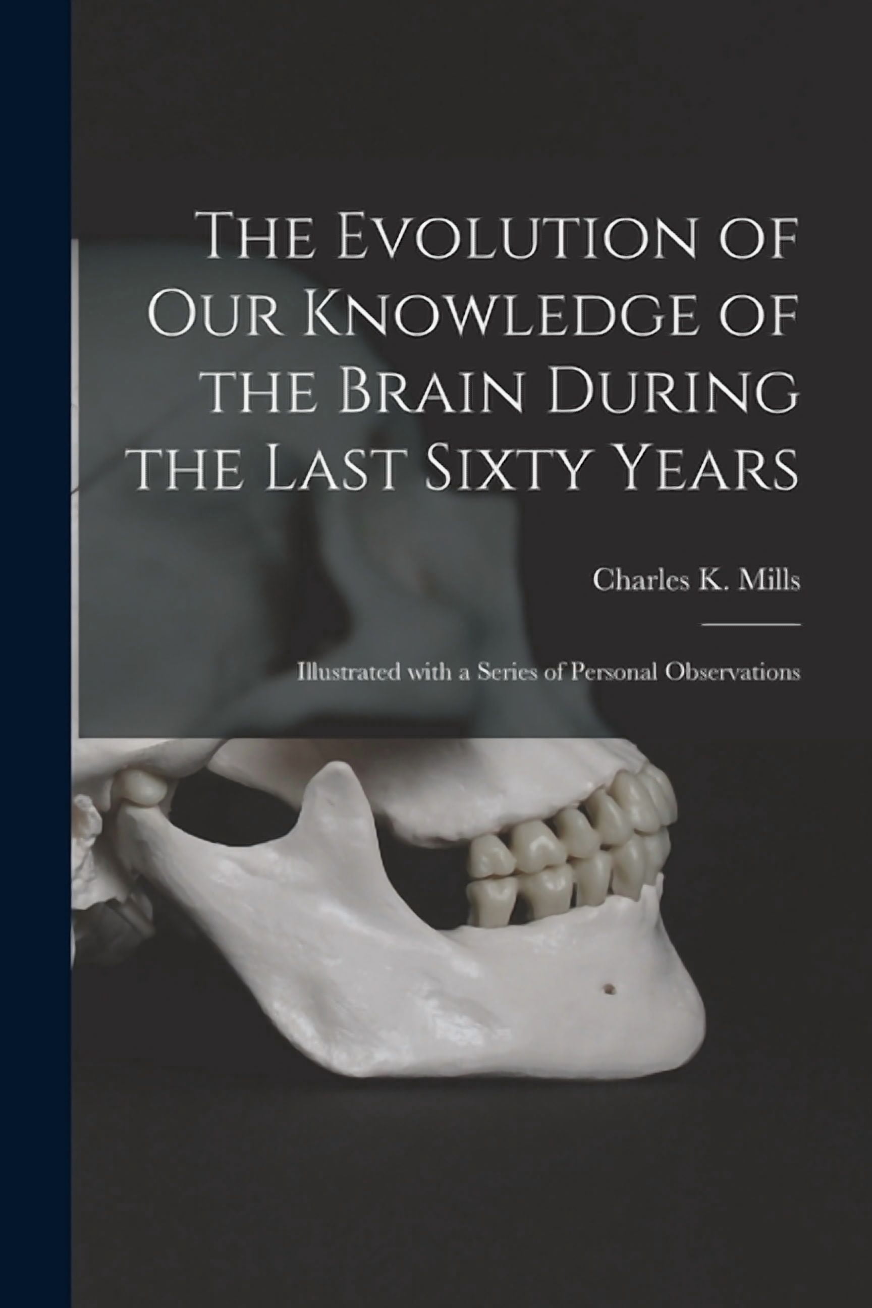 The Evolution of Our Knowledge of the Brain During the Last Sixty Years ...