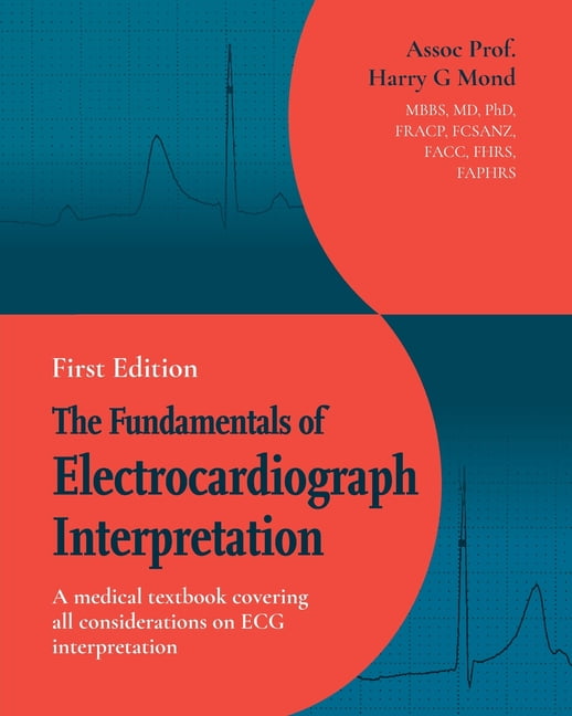 The Fundamentals of Electrocardiograph Interpretation: A medical ...