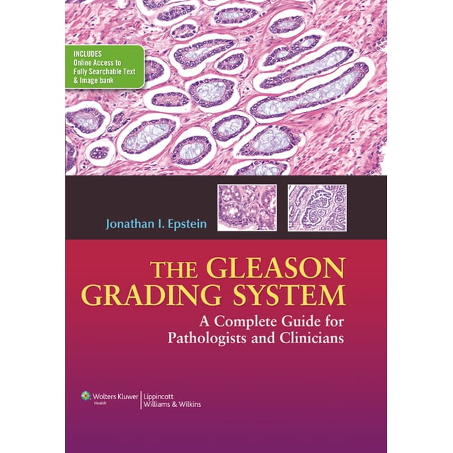 The Gleason Grading System: A Complete Guide for Pathologist and ...