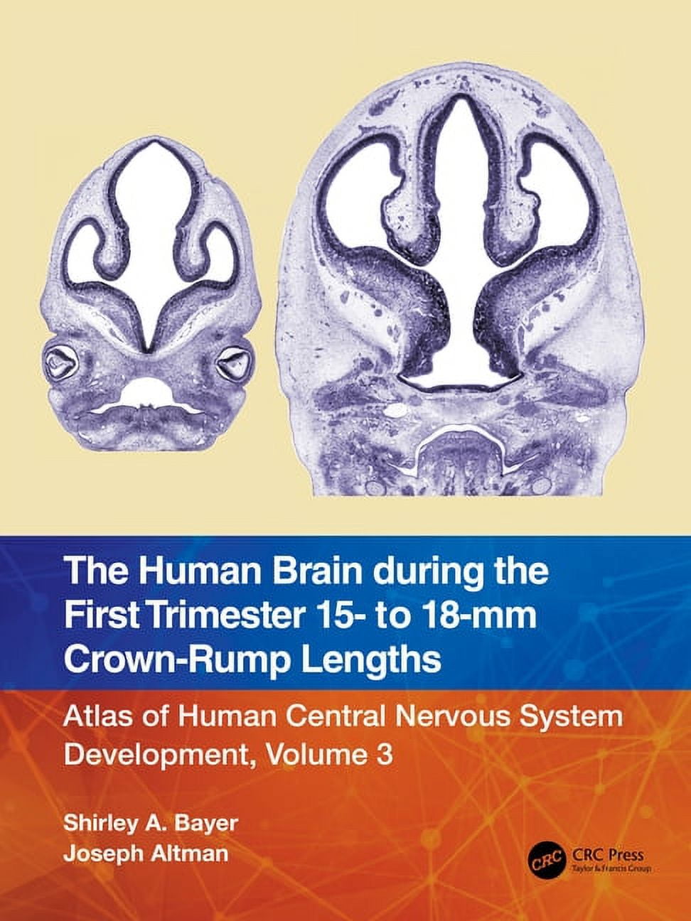 The Human Brain During the First Trimester 15- To 18-MM Crown-Rump ...