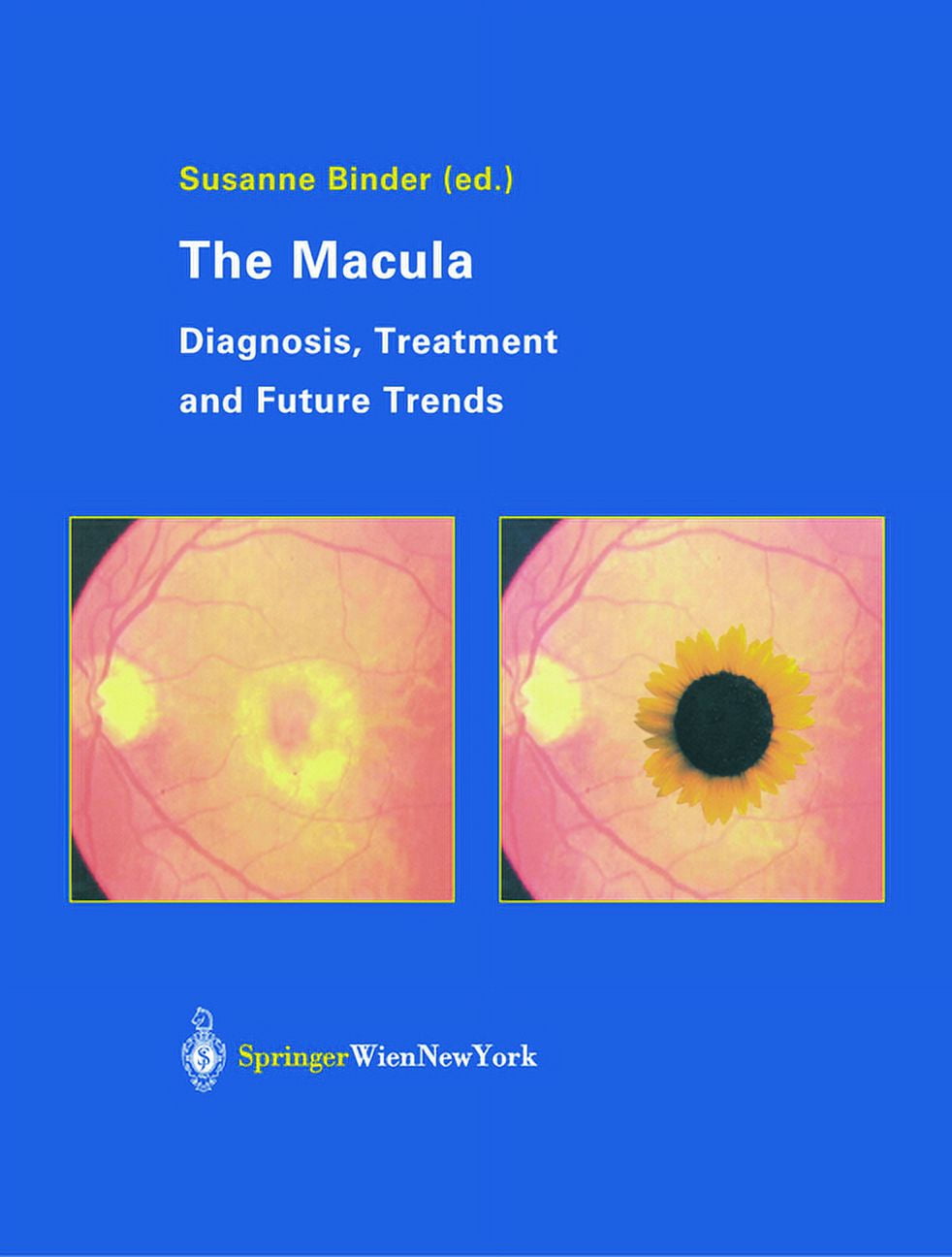 The Macula: Diagnosis, Treatment and Future Trends, (Hardcover ...