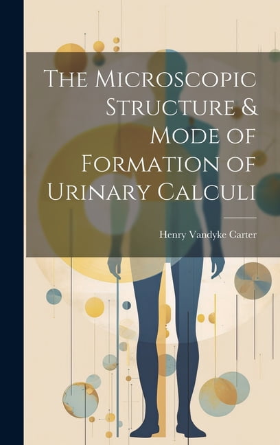 The Microscopic Structure & Mode of Formation of Urinary Calculi ...