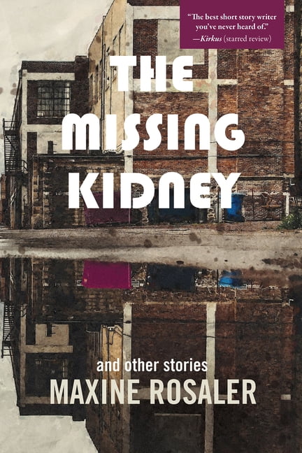 The Missing Kidney and Other Stories: And Other Stories, (Paperback ...