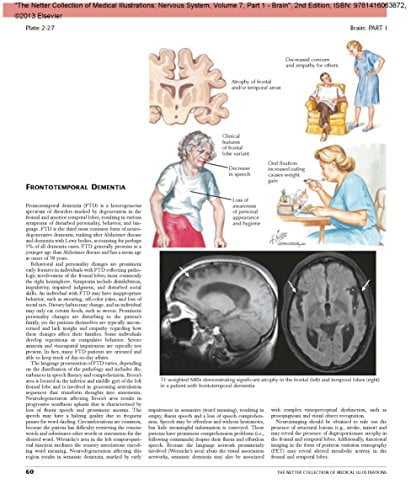 Pre-Owned The Netter Collection of Medical Illustrations: Nervous ...