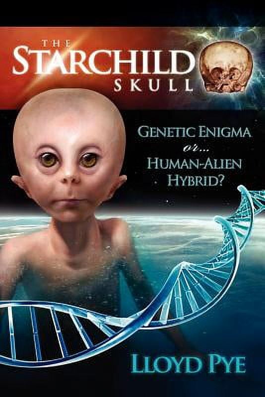 The Starchild Skull -- Genetic Enigma or Human-Alien Hybrid? -- Lloyd ...