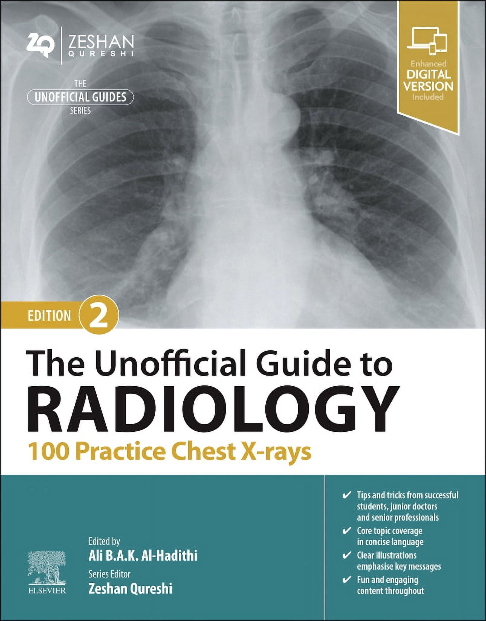 The Unofficial Guide to Radiology: 100 Practice Chest X-rays - Walmart.com