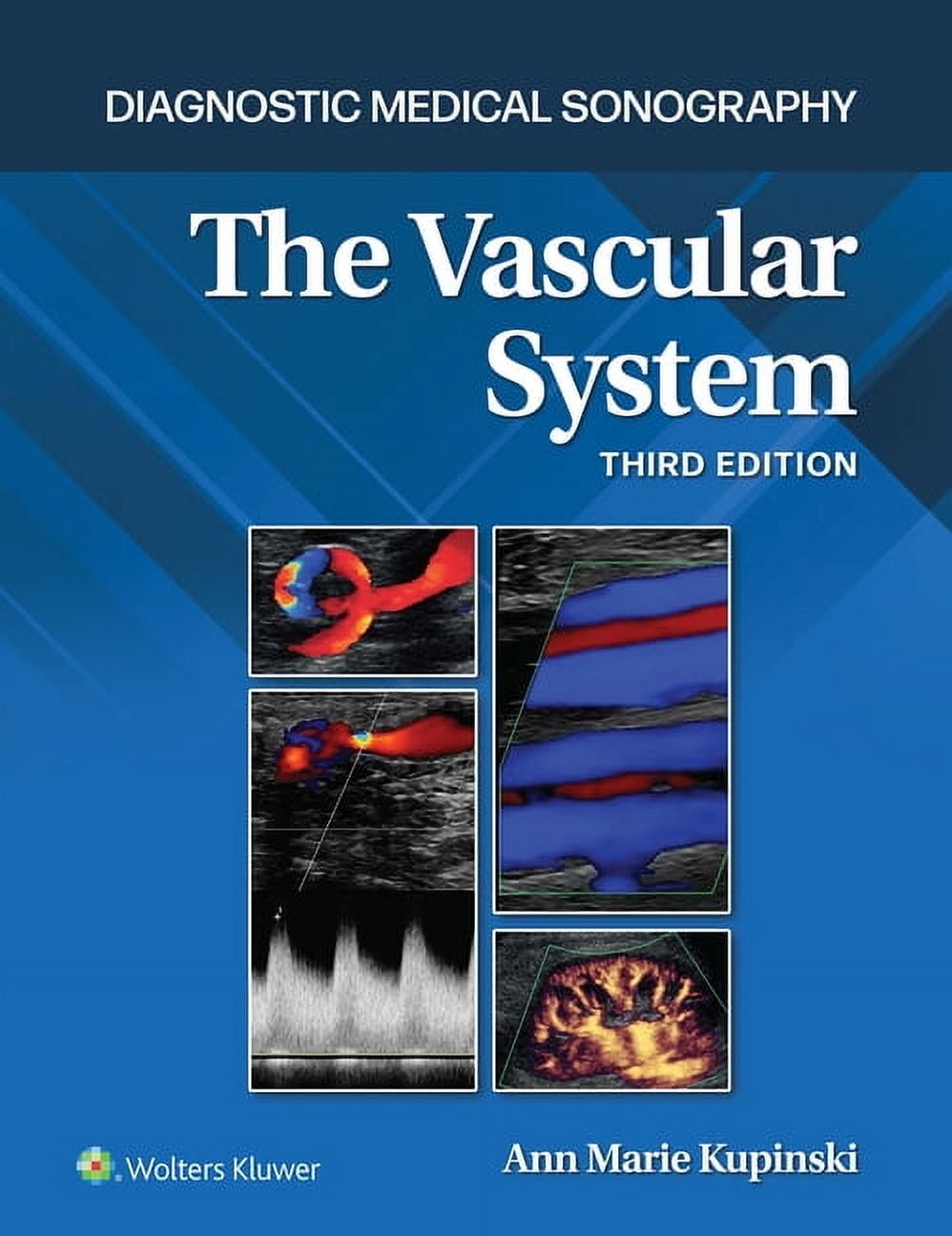 Lippincott Connect The Vascular System, (Hardcover) - Walmart.com