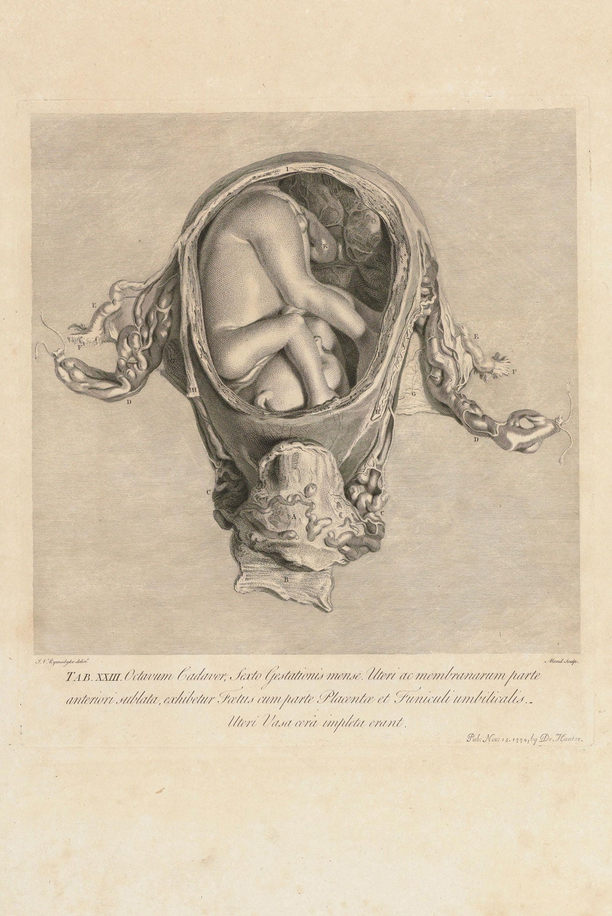 The anatomy of gravid uterus Anatomy of Human Body Photographic Print ...