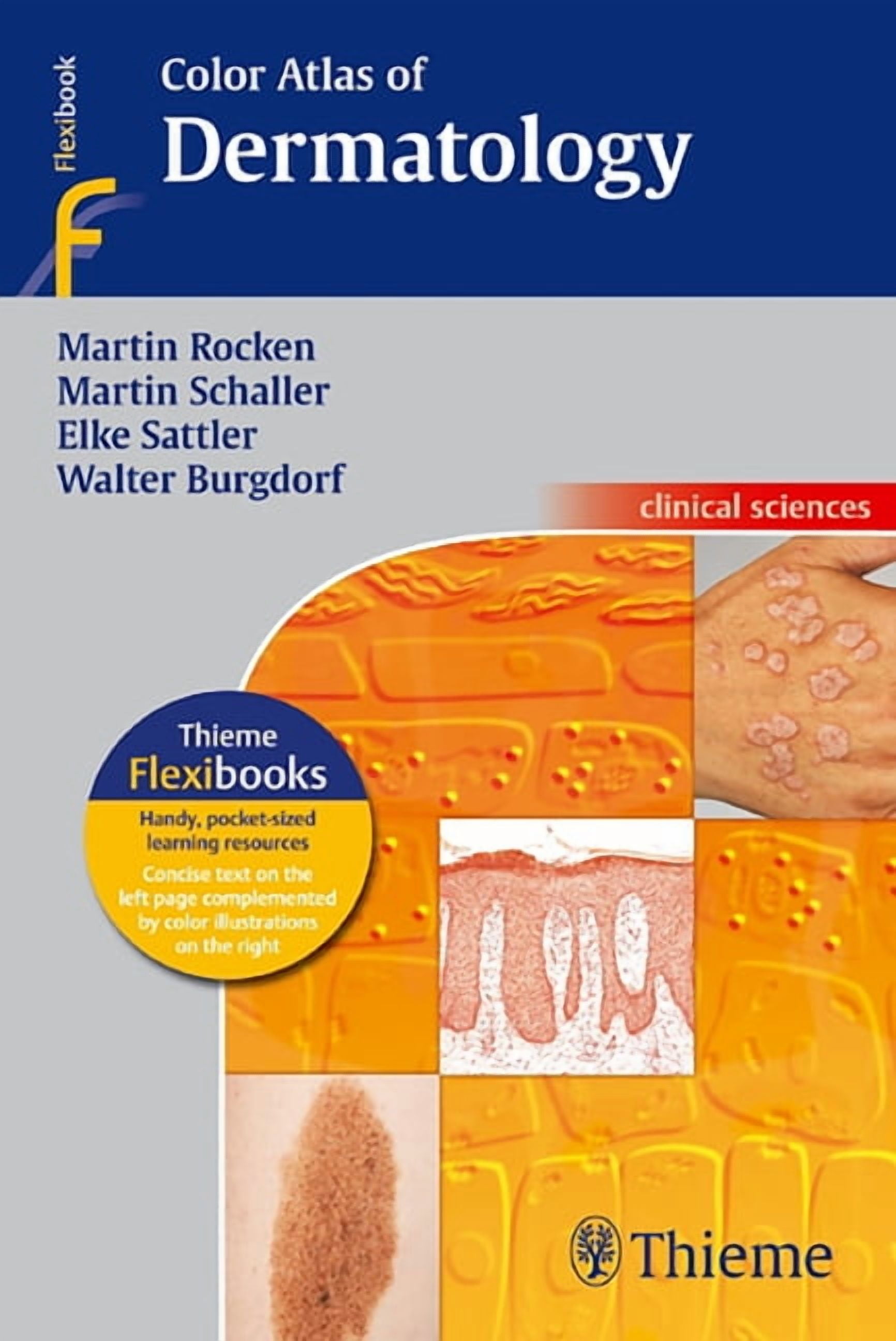 Thieme Flexibooks Color Atlas of Dermatology, (Paperback) - Walmart ...